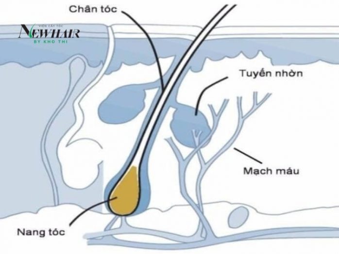 Nang tóc là gì, ảnh hưởng như thế nào khi cấy tóc?