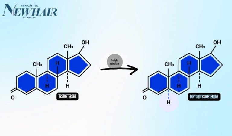 Hormone DHT Là Gì? Hormone DHT Có Gây Hói Đầu Không?