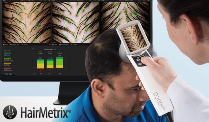 Soi Nang Tóc Ở Đâu? Công Nghệ Soi Nang Tóc AI Tại NEWHAIR