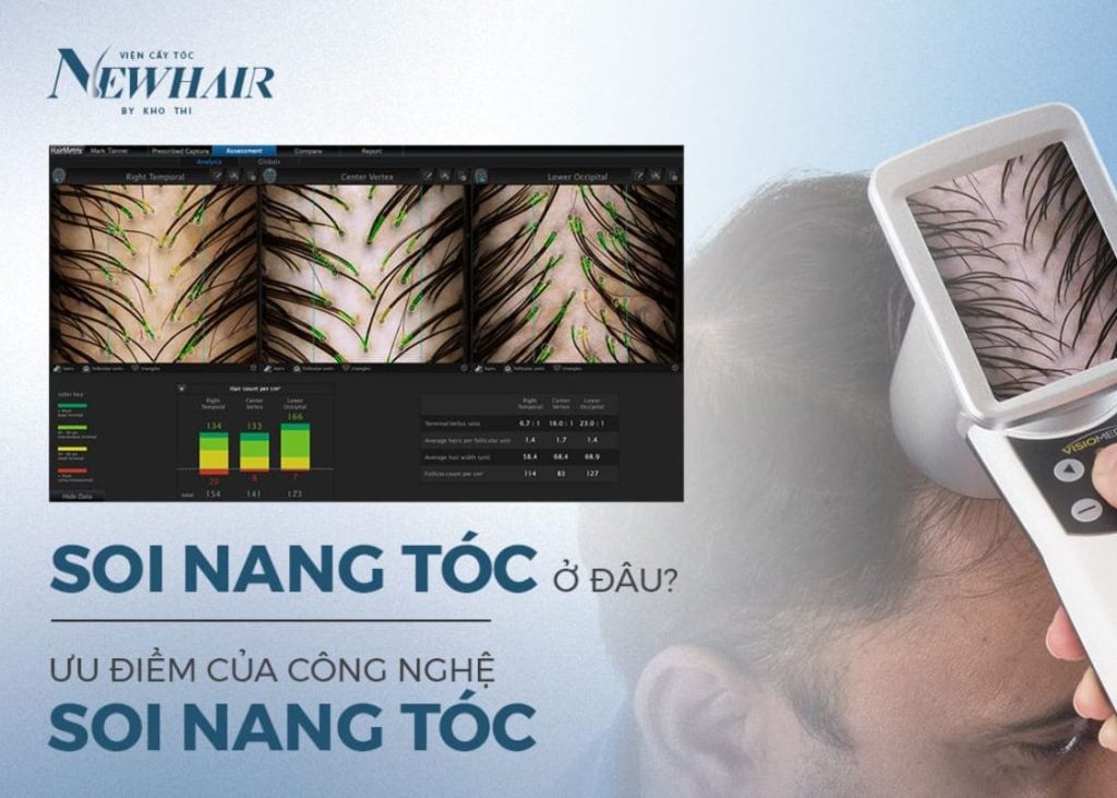 Soi Nang Tóc Ở Đâu? Công Nghệ Soi Nang Tóc AI Tại NEWHAIR
